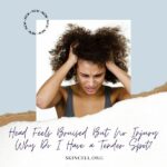 Head Feels Bruised But No Injury: Why Do I Have A Tender Spot ...