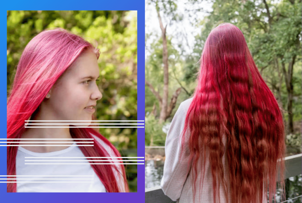 Why Is My Scalp Weeping Clear Fluid? - Skincell.org